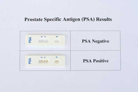 What does it mean to have an elevated PSA? | Urology Associates P.C.