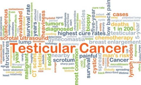 A Stage-by-Stage Look at Testicular Cancer Treatment Options | Urology ...